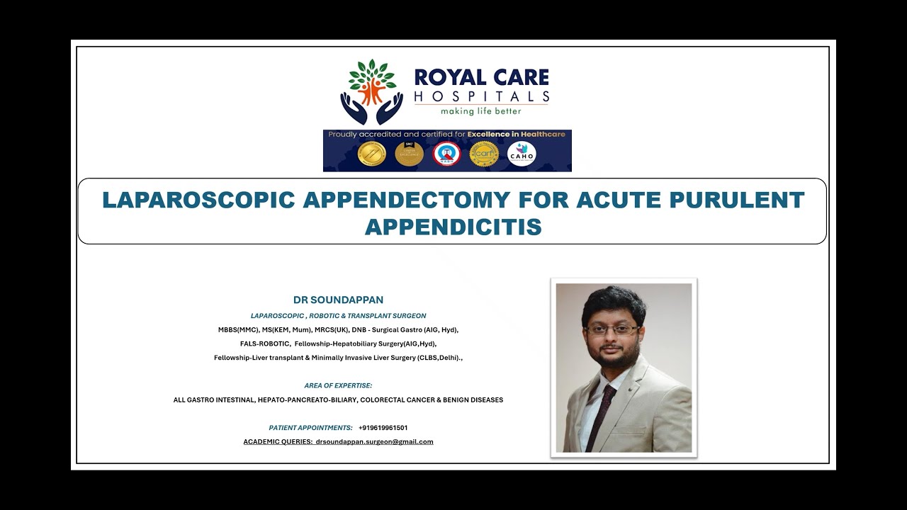 Emergency Laparoscopic Appendectomy | Acute Appendicitis Surgery | Dr ...