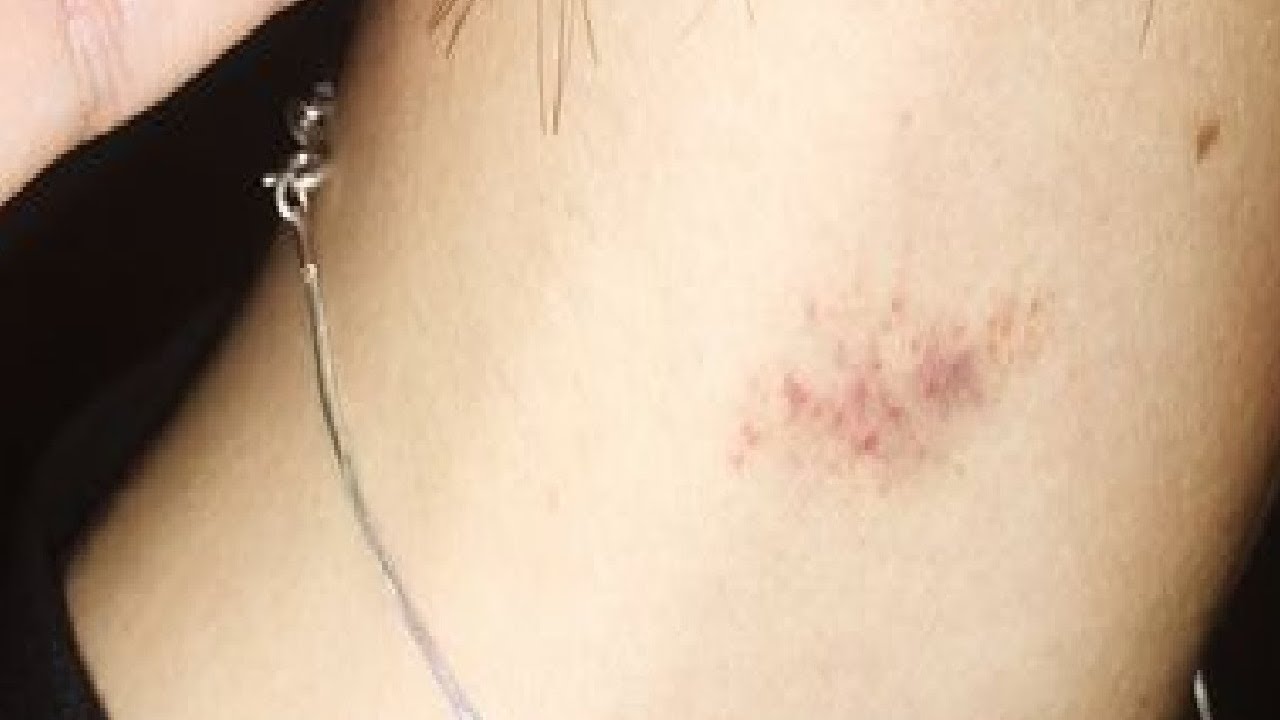 how to give a hickey leaving a mark tutorial - YouTube