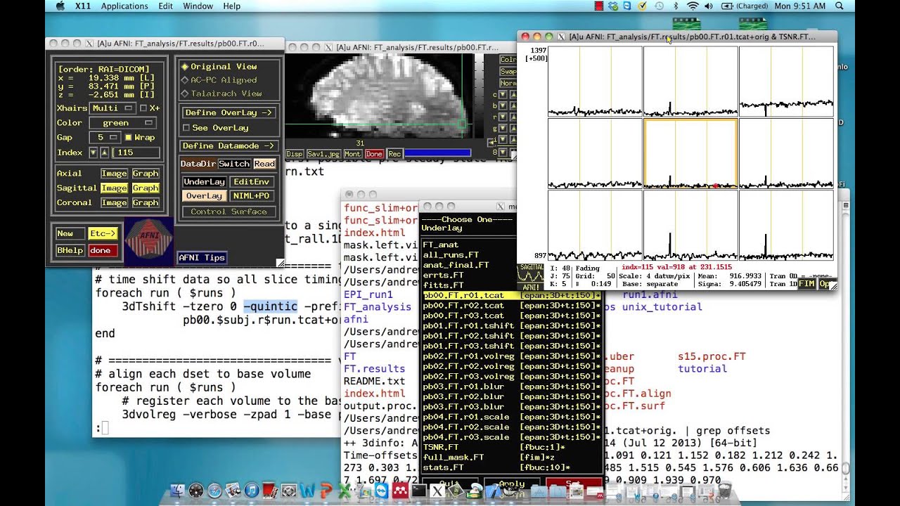 AFNI Start To Finish Tutorial, Part 10: Slice Timing Correction - YouTube