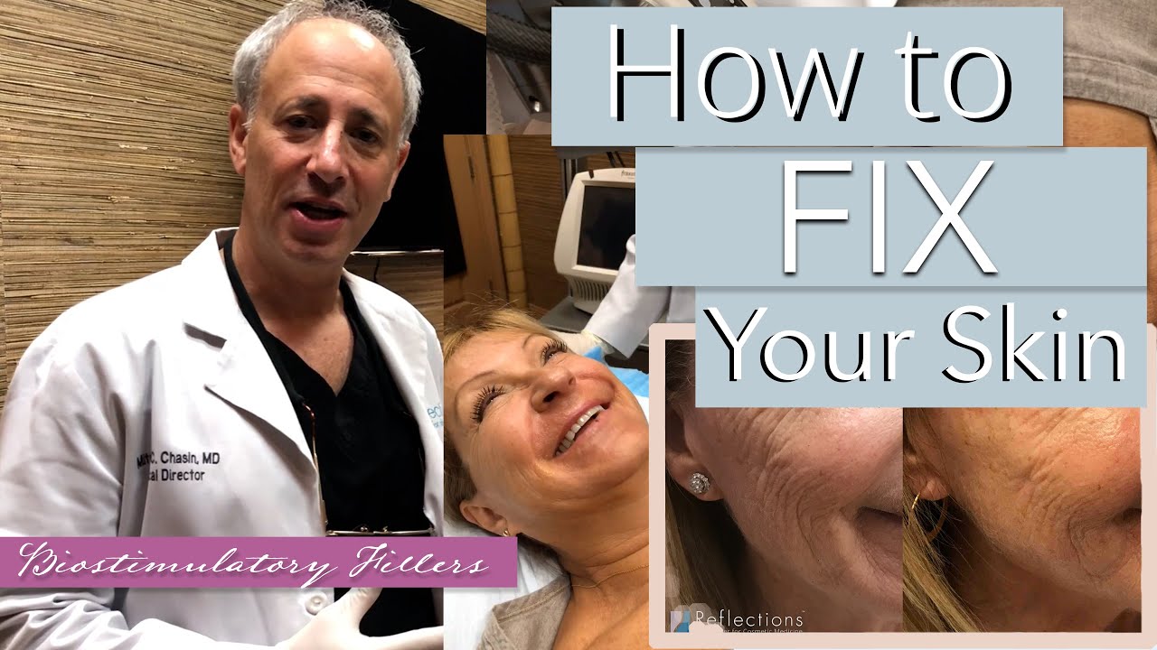 Biostimulatory Fillers - How to Fix Your Skin with #HyperdiluteRadiesse ...