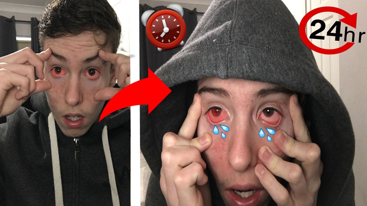 No Blinking For 24 Hours Challenge Youtube