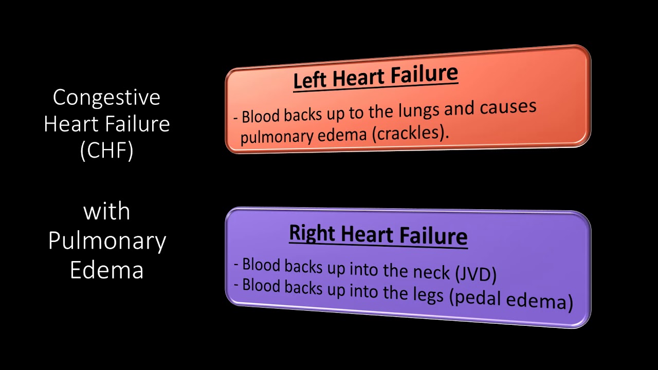 EMT - Cardiac Emergencies - YouTube