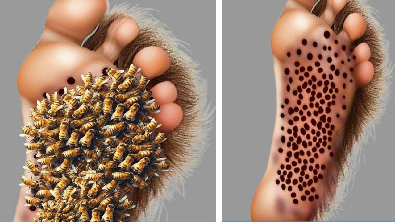 ASMR Sticky Bees On Foot Cleaning - YouTube