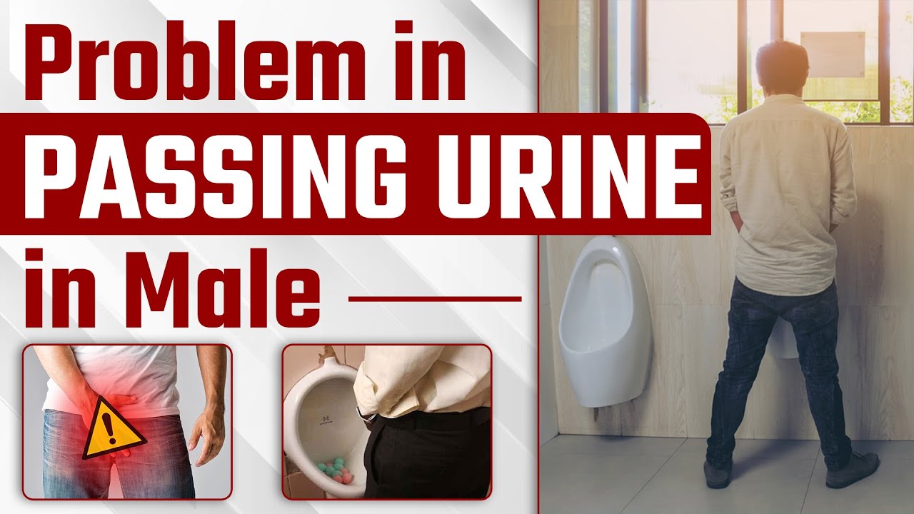 क्या वैरीकोसेल के कारण पेशाब बाहर नहीं आता ? | Problem in Passing Urine ...