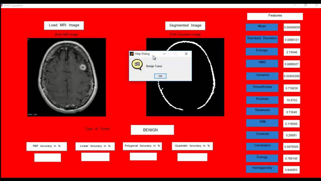 SVM Classifiers MATLAB PROJECTS - YouTube