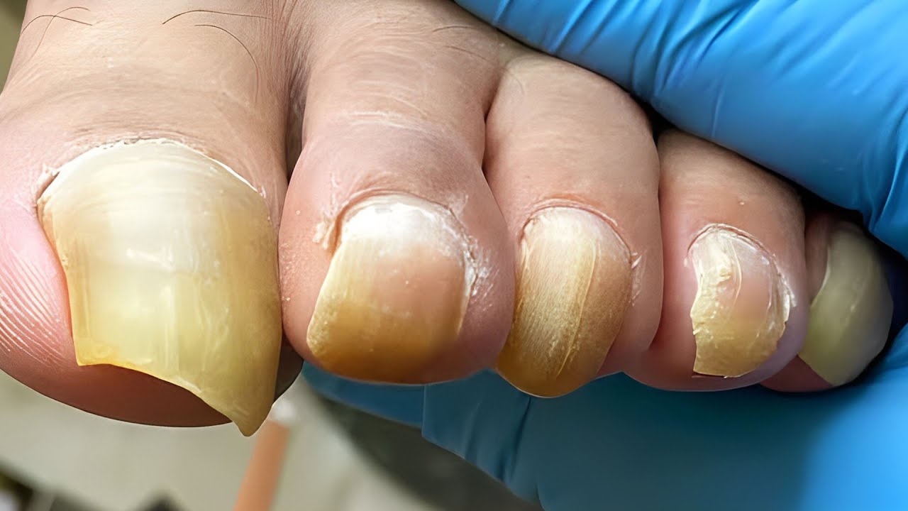 The old man's super roll armor! very sharp, trim carefully【Pedicure ...