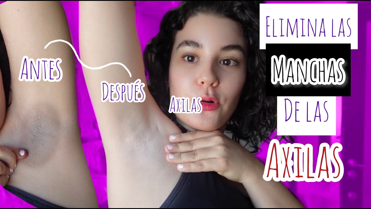 ¿MANCHAS EN LAS AXILAS? remedio natural - YouTube