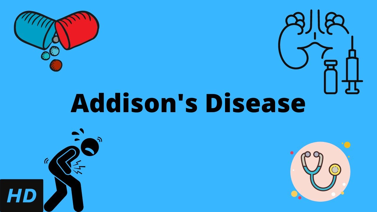 Addison s Disease Causes Signs And Symptoms Diagnosis And Treatment