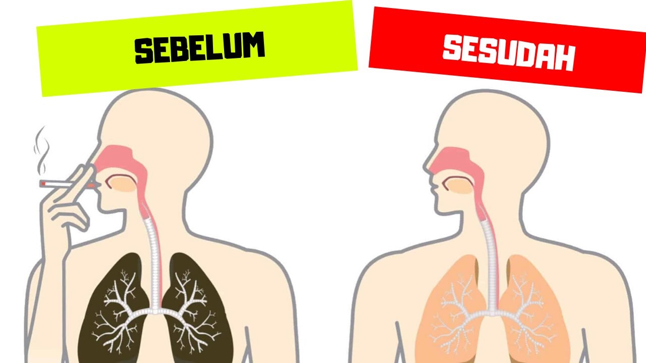 Perokok, Ini 10 Cara Mudah Singkirkan Sisa Nikotin dalam Tubuh - YouTube