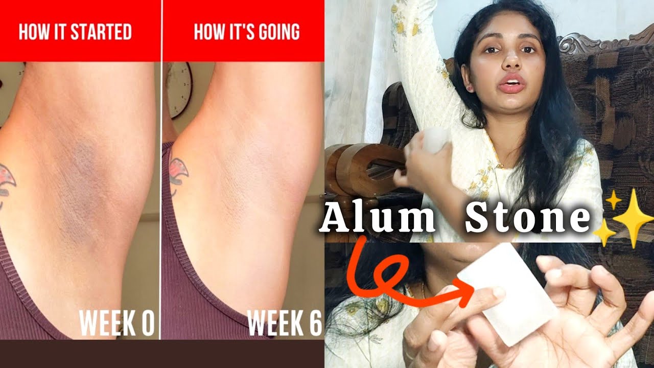 💥Alum stone use ചെയ്തതുകൊണ്ട് 💯 മാറ്റങ്ങൾ വിചാരിച്ചില്ല 🔥| Alum stone ...