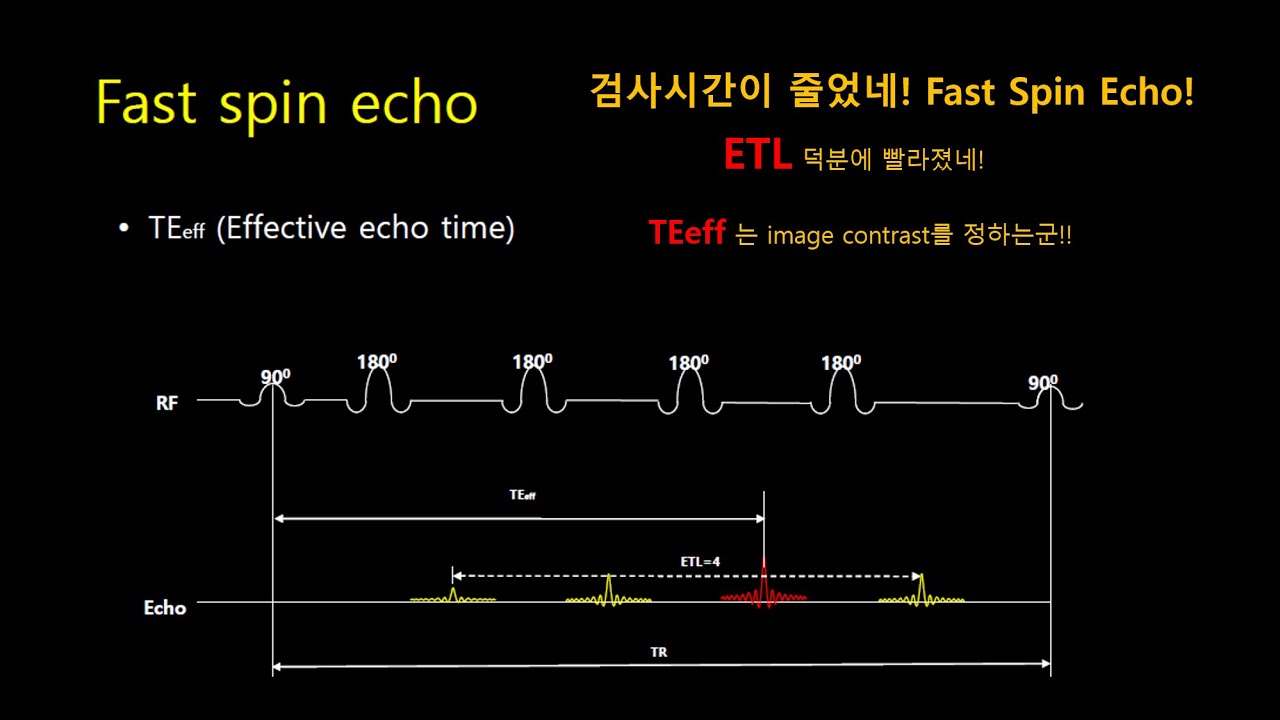 Fast spin echo 패스트 스핀에코 " 스캔시간이 긴 Spin echo의 단점을 보완한다." - YouTube
