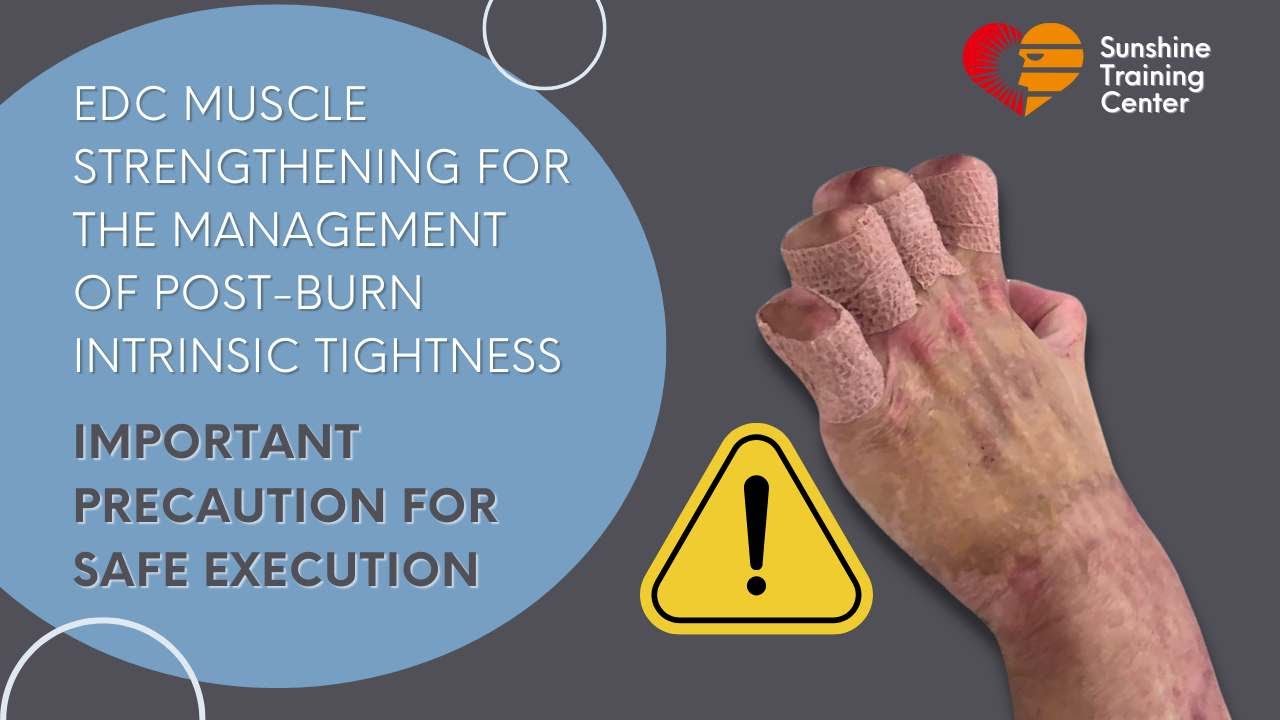 EDC muscle strengthening exercise for post-burn intrinsic tightness: Be ...