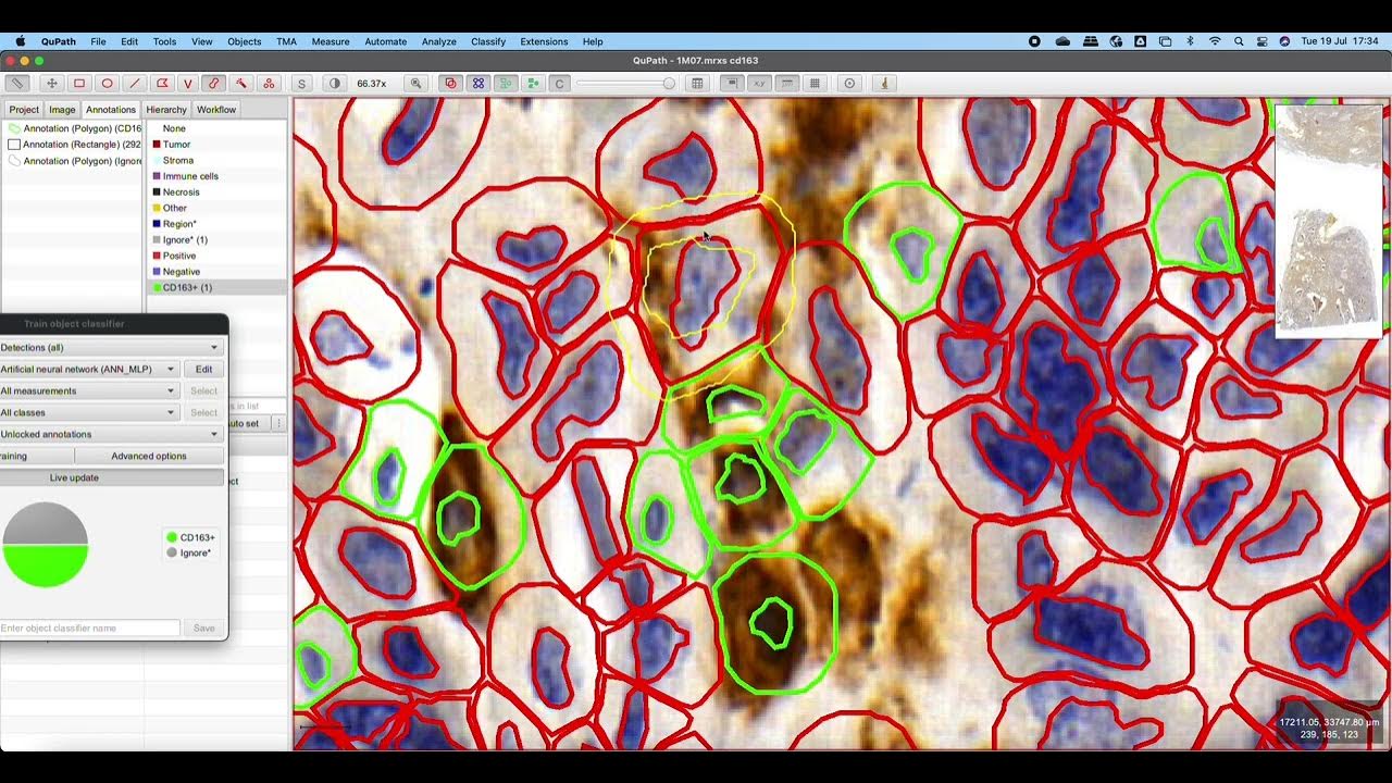 Training an Object Classifier in Qupath - YouTube