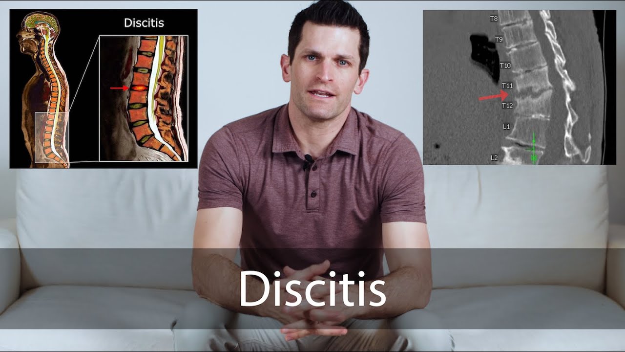 Discitis // everything you need to know - YouTube