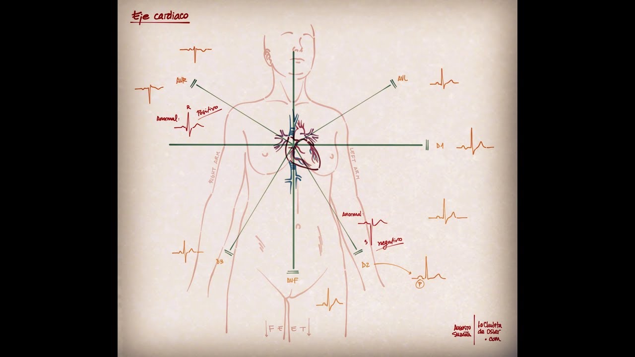 Para entender el eje cardiaco - Una sencilla revisión - YouTube