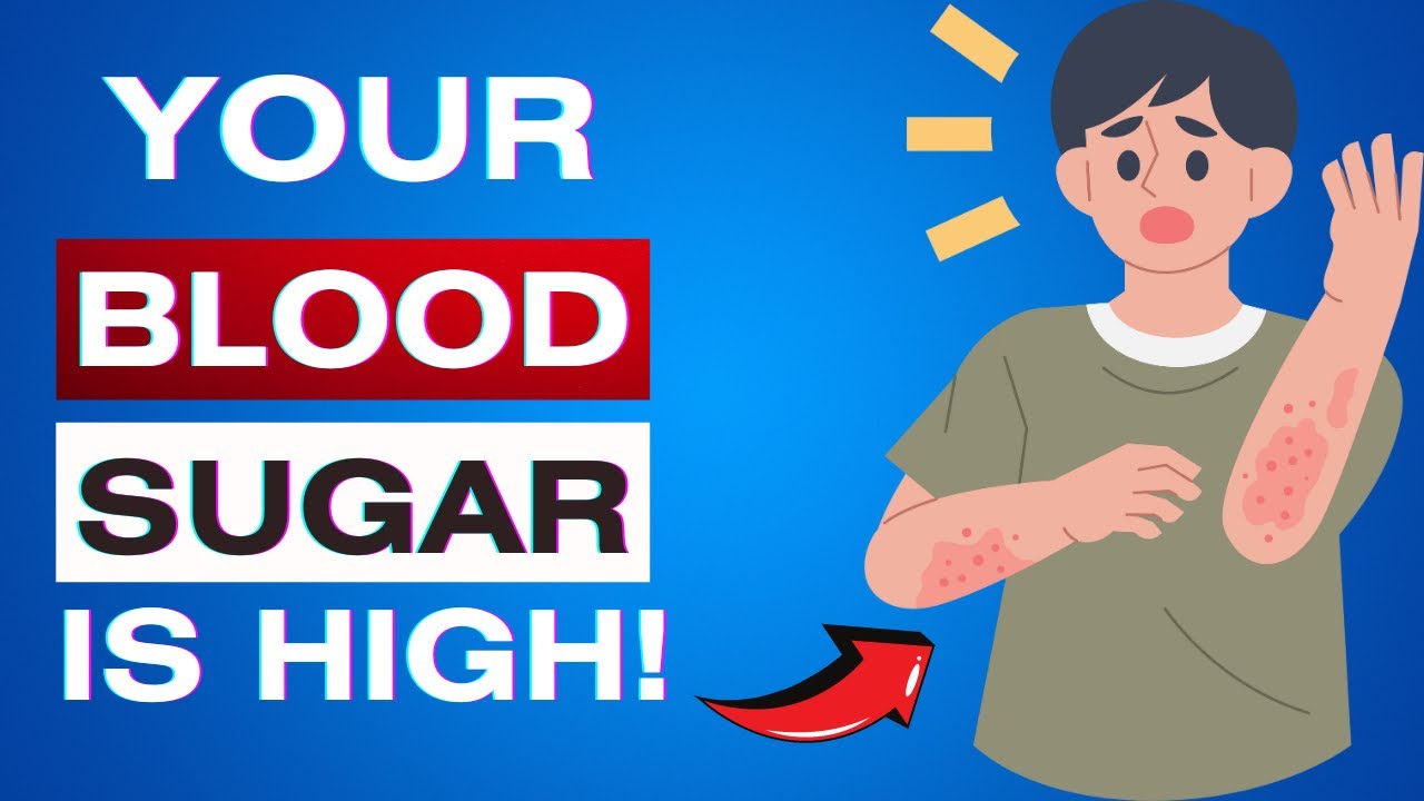 Don't Ignore These 16 Alarming High Blood Sugar Symptoms! - YouTube