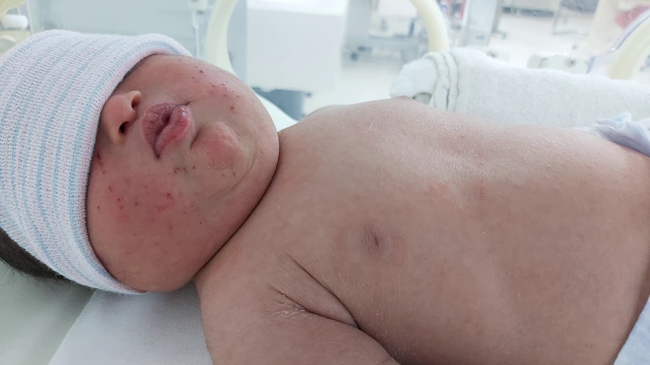 case 425 periodic breathing, shallow rapid or irregular breathing with ...