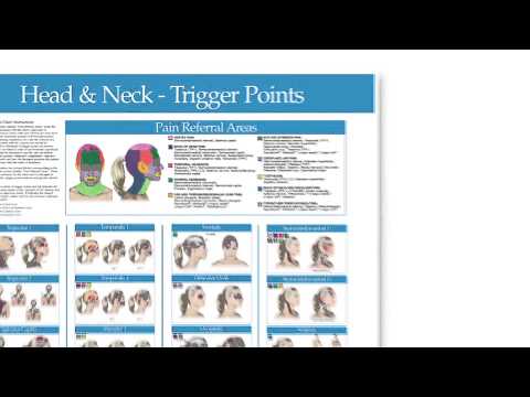 Highlights Trigger Point Wall Chart Head and Neck Chart - YouTube