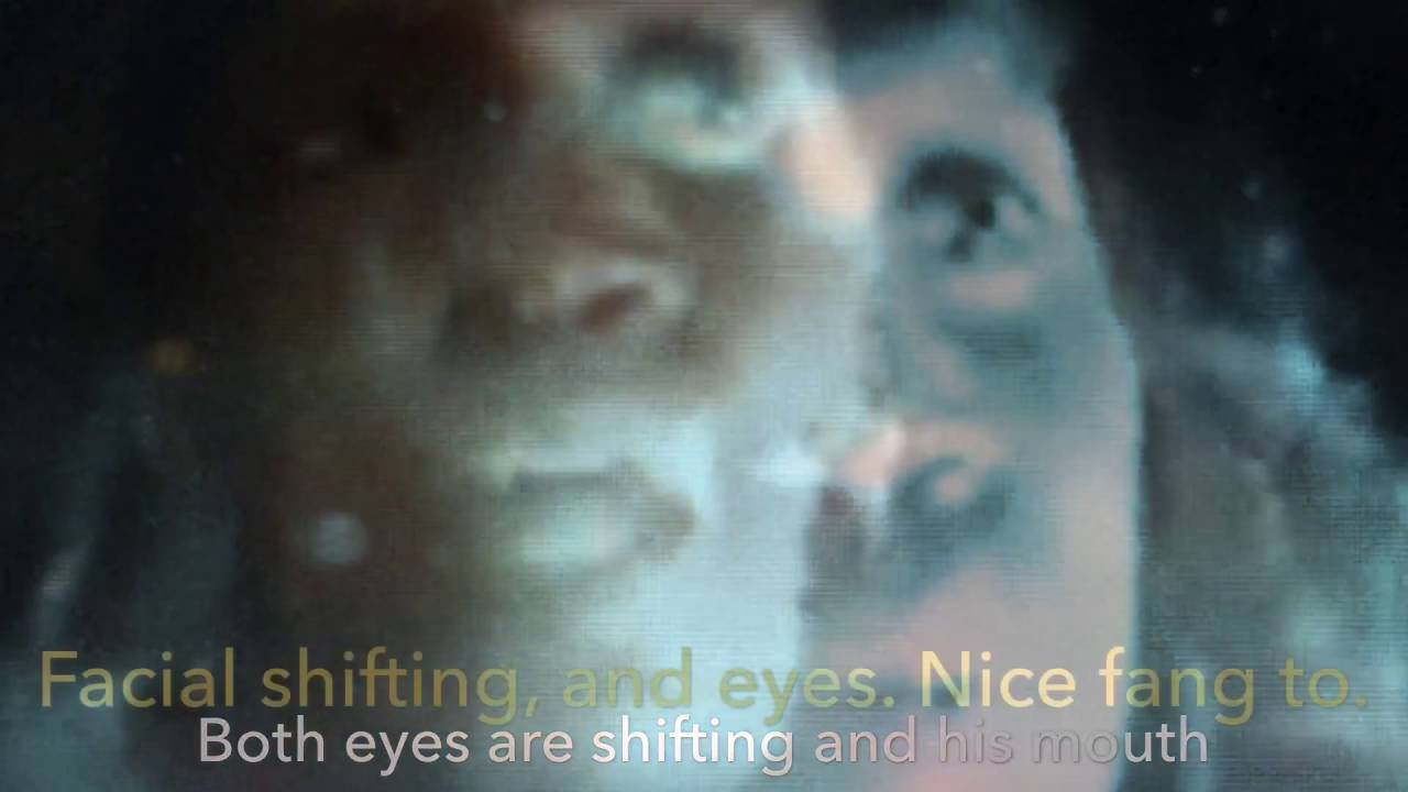 Crazy forehead protrusions and more! - YouTube