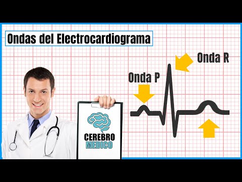 Ondas del Electrocardiograma | ▷ Como leer un EKG paso a paso