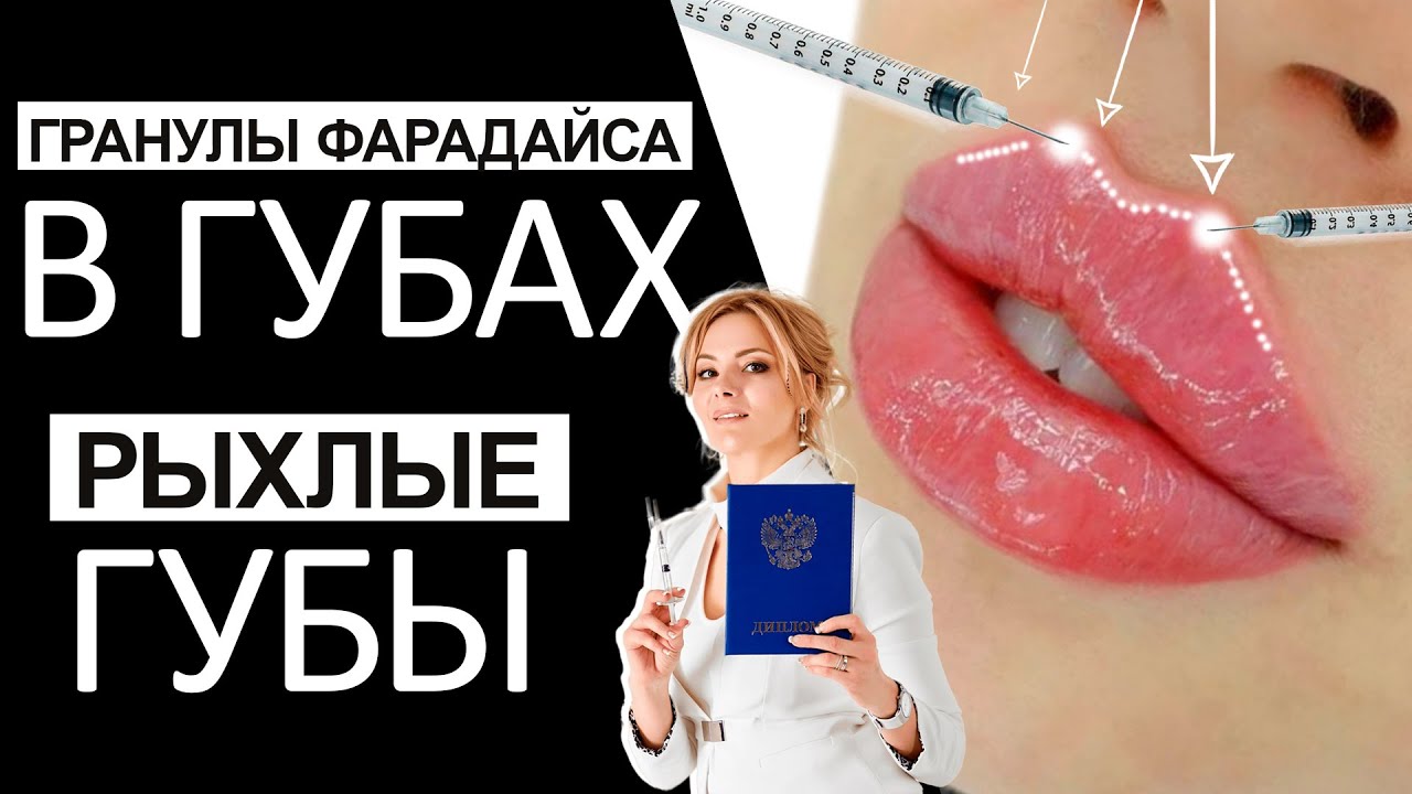 Гранулы Фарадайса в губах Рыхлые губы Увеличение губ Видео урок от