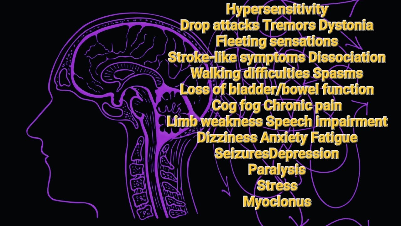 FND. What are my symptoms? - YouTube