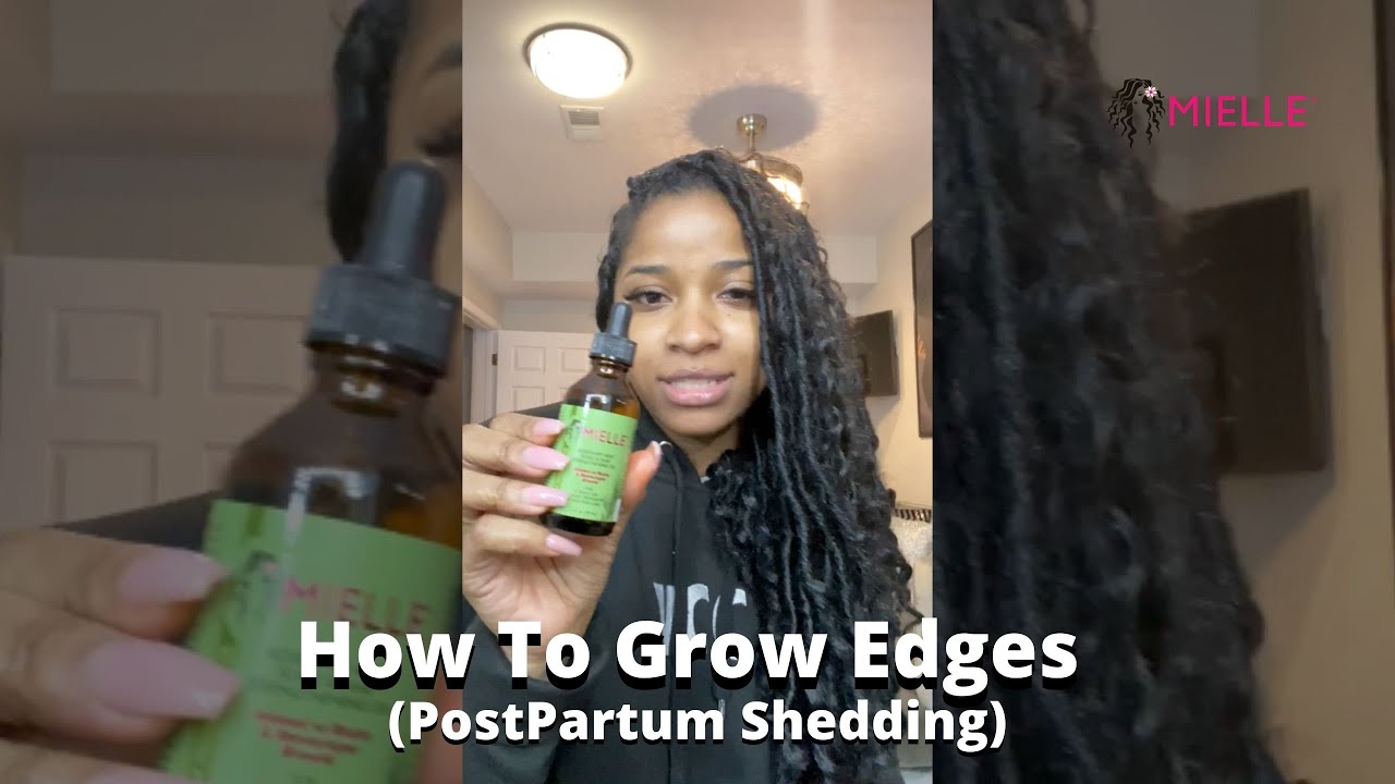 How To Grow Edges (PostPartum Shedding) | Mielle Rosemary Mint ...