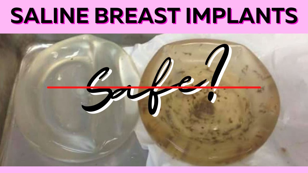 Are Saline Breast Implants Safer Youtube