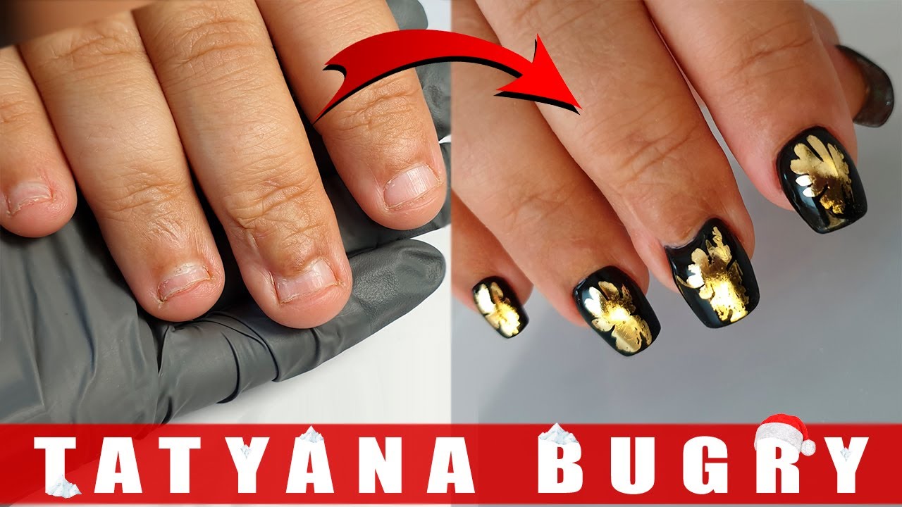 Part 2 HUGE & Difficult Transformation on Bitten Nails - YouTube