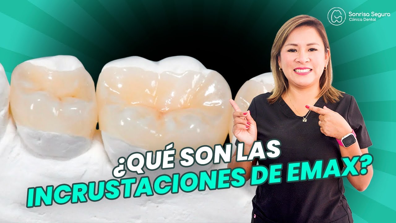 Incrustaciones de Emax: ¿Qué son y cuáles son sus beneficios? - YouTube
