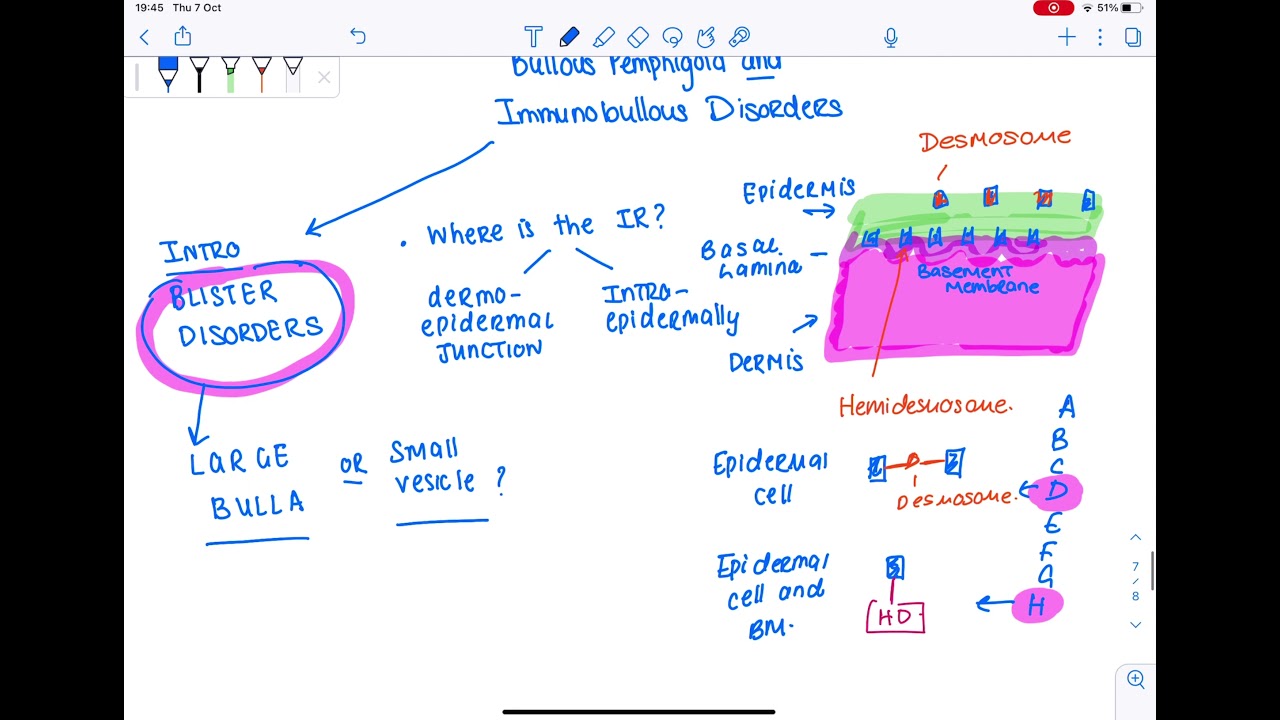 IMMUNOBULLOUS DISORDERS and Bullous pemphigoid - YouTube