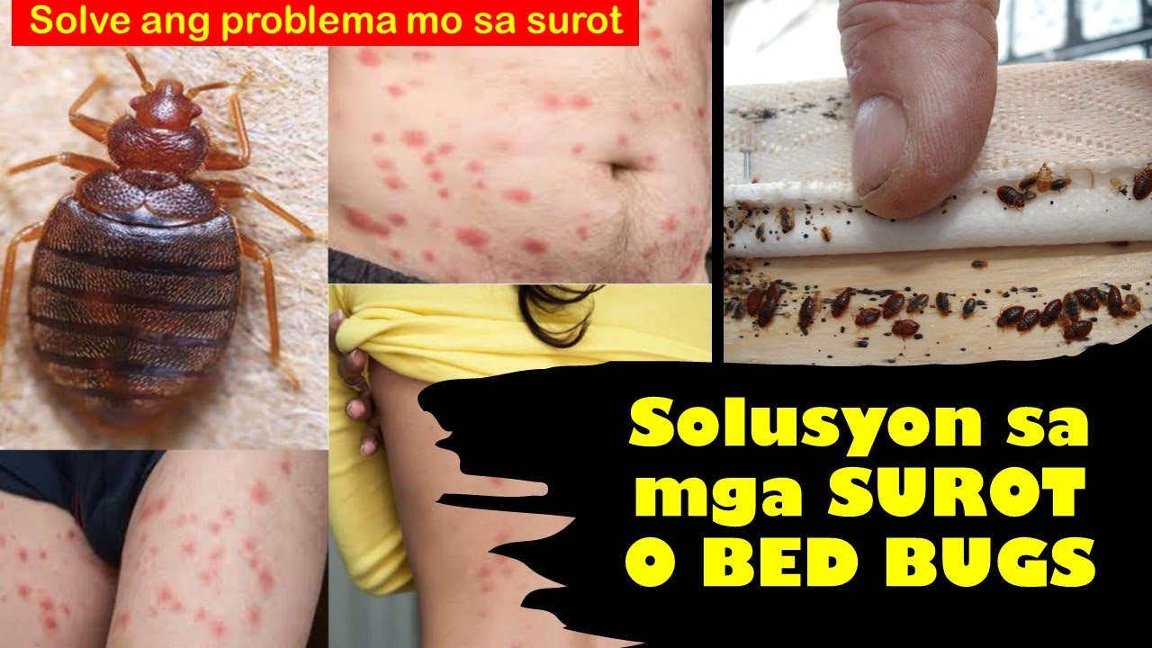 Problema mo ba ang SUROT patay ang surot dito panuorin mo kaibigan ...