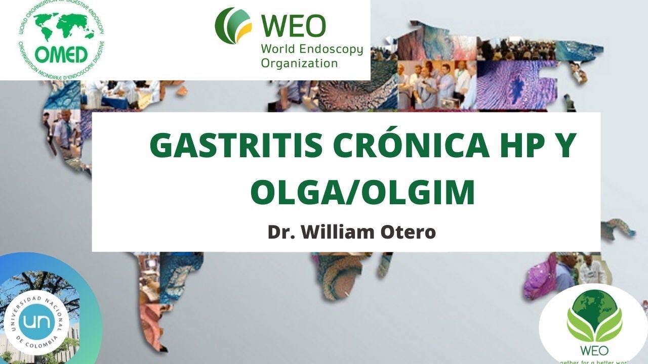 Gastritis Crónica; Hp y OLGA/OLGIM en la práctica. Dr. WIlliam Otero ...