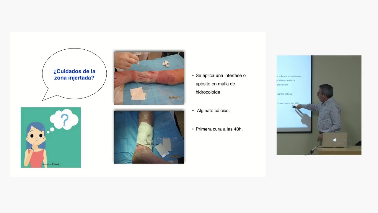 Injertos/sellos de piel en úlceras crónicas - YouTube