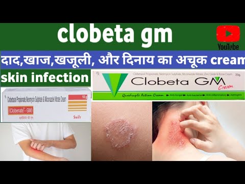 clobeta gm cream use in face । dose, composition, Side effects ...