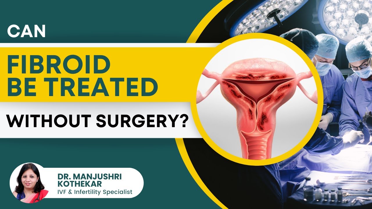 Impact of Fibroid on Infertility. Can Fibroid be Treated Without ...
