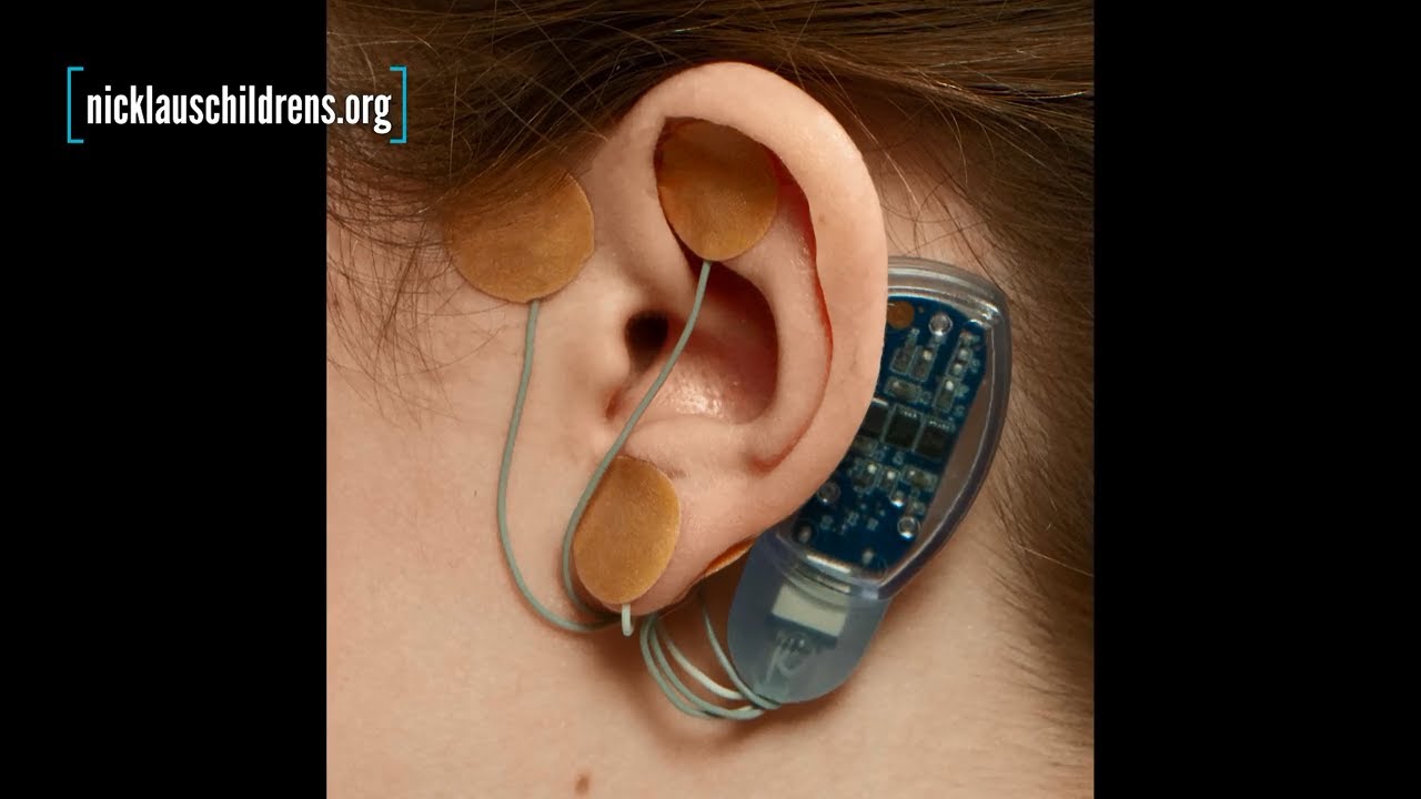 Are There Alternatives to Medication for IBS? - Dr. Heidi Gamboa ...