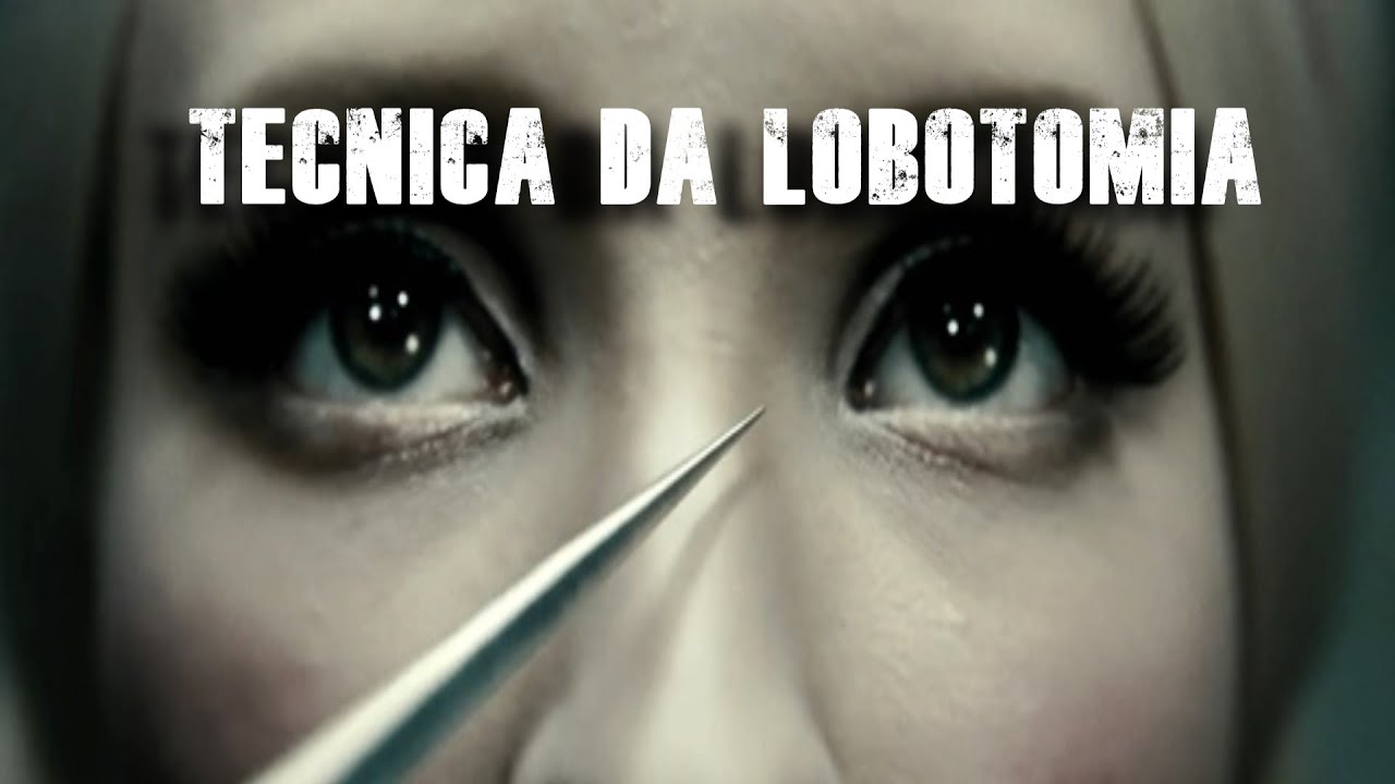 A TÉCNICA DA LOBOTOMIA [+18] - YouTube