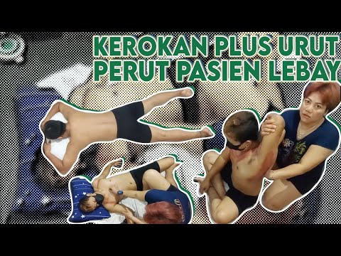 Kerokan plus urut perut pasien lebay