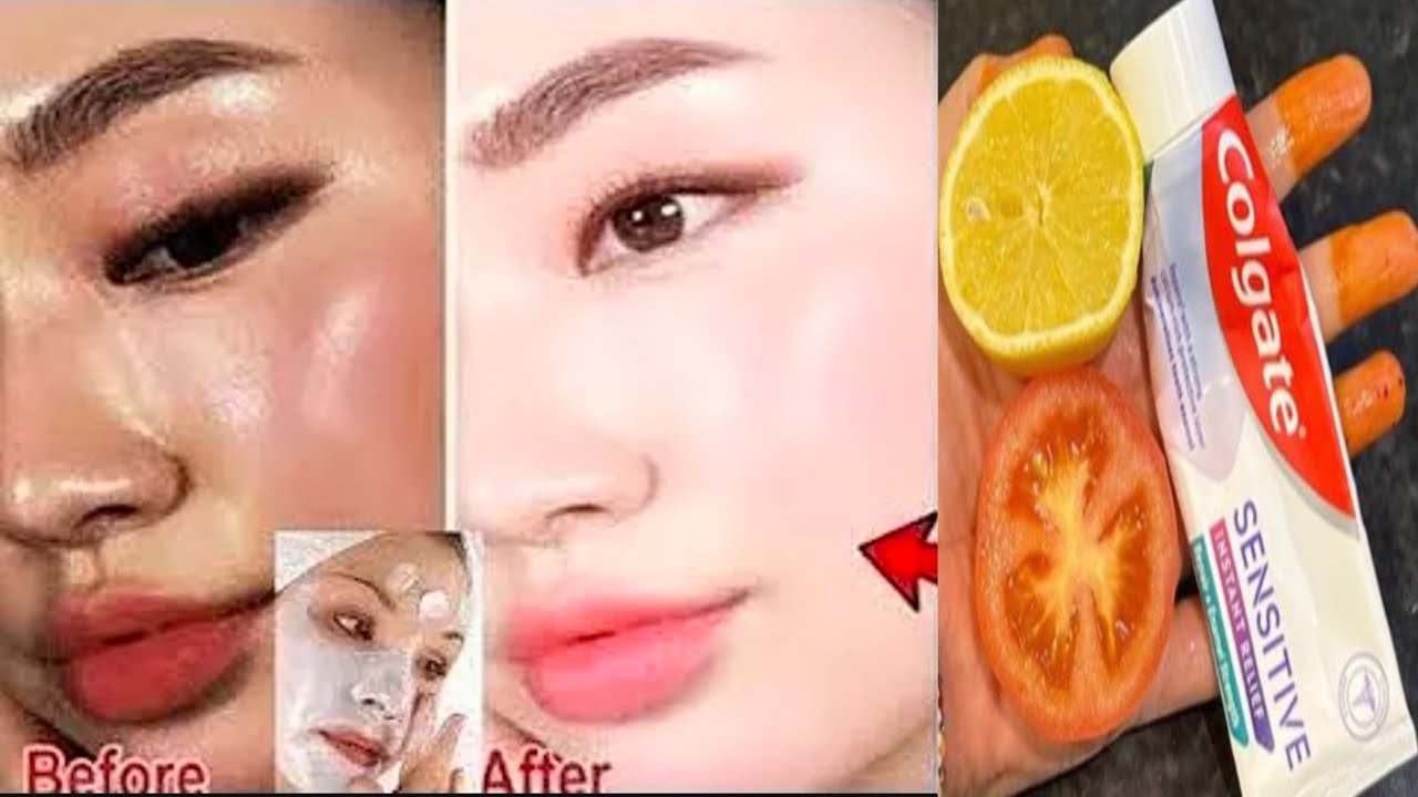Skin Whitening Colgate Home Toothpaste Treatments Lifestyle Tips # Skin ...