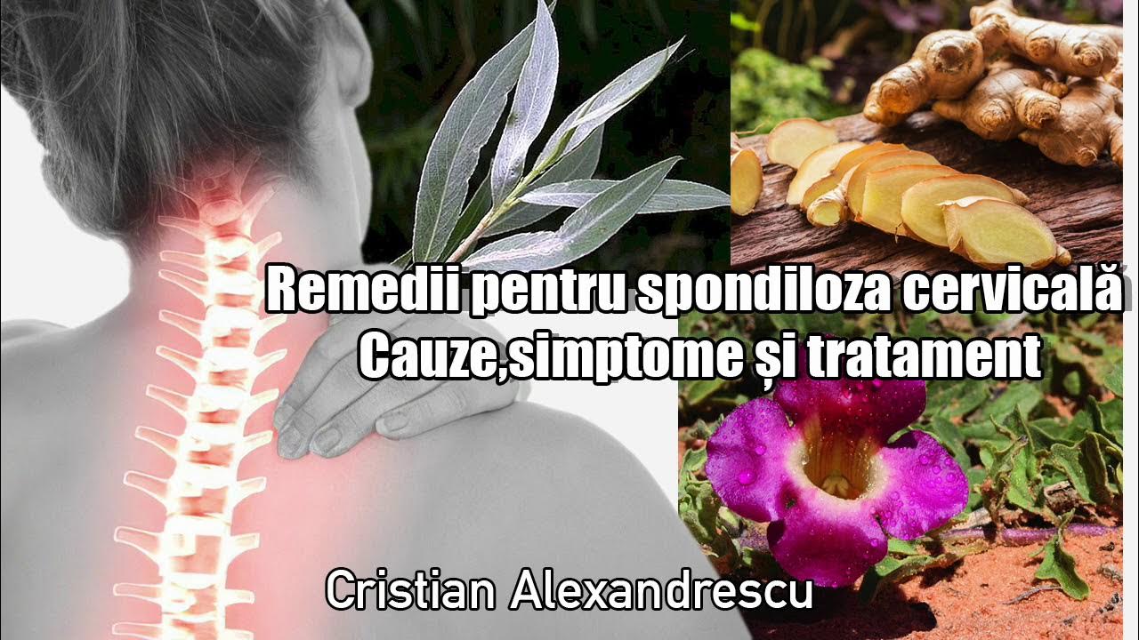 Remedii Pentru Spondiloza Cervicala -Cauze, Simptome Si Tratament - YouTube