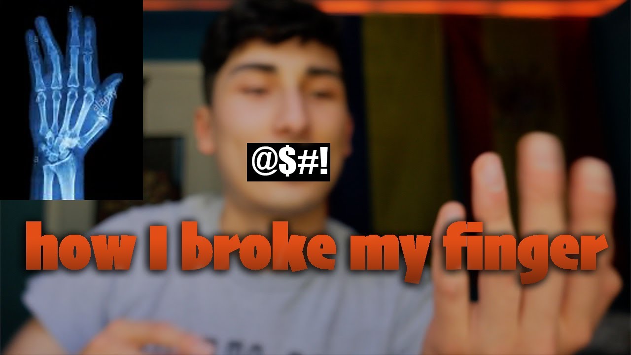 how I broke my finger - YouTube