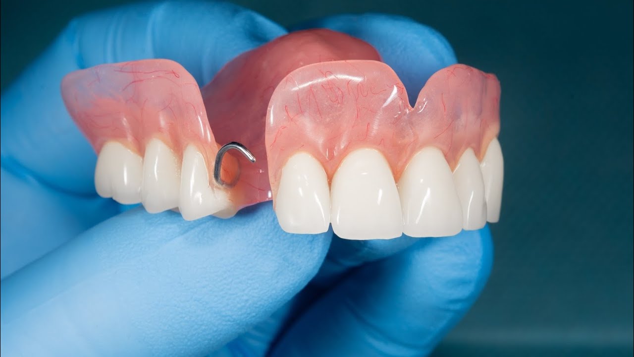 المحاضرة 11 بروس مرحلة ثالثة الجزء الاول Types of clasps assembly ...