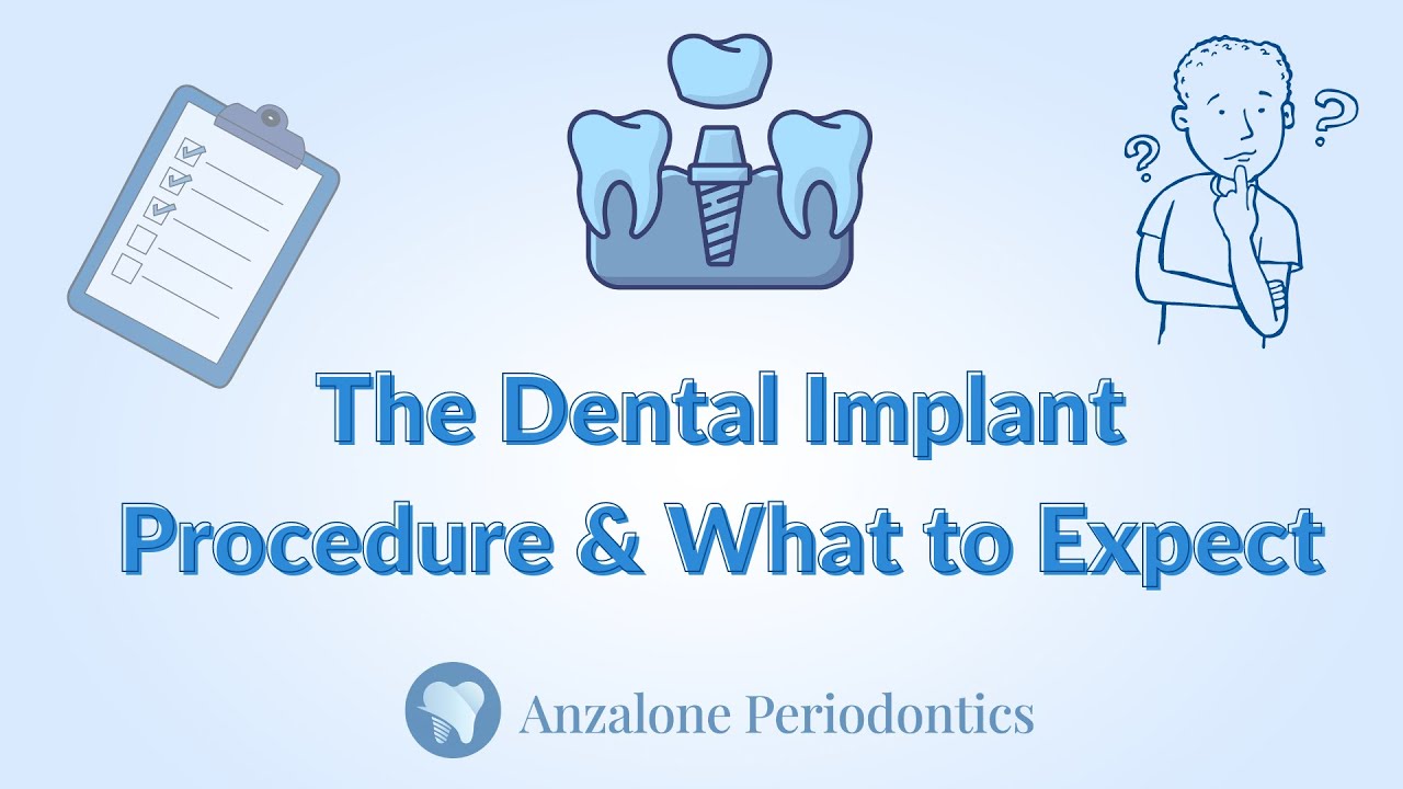 Anzalone Periodontics - The Dental Implant Procedure and What to Expect ...