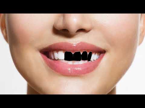 My shiny teeth and me - YouTube