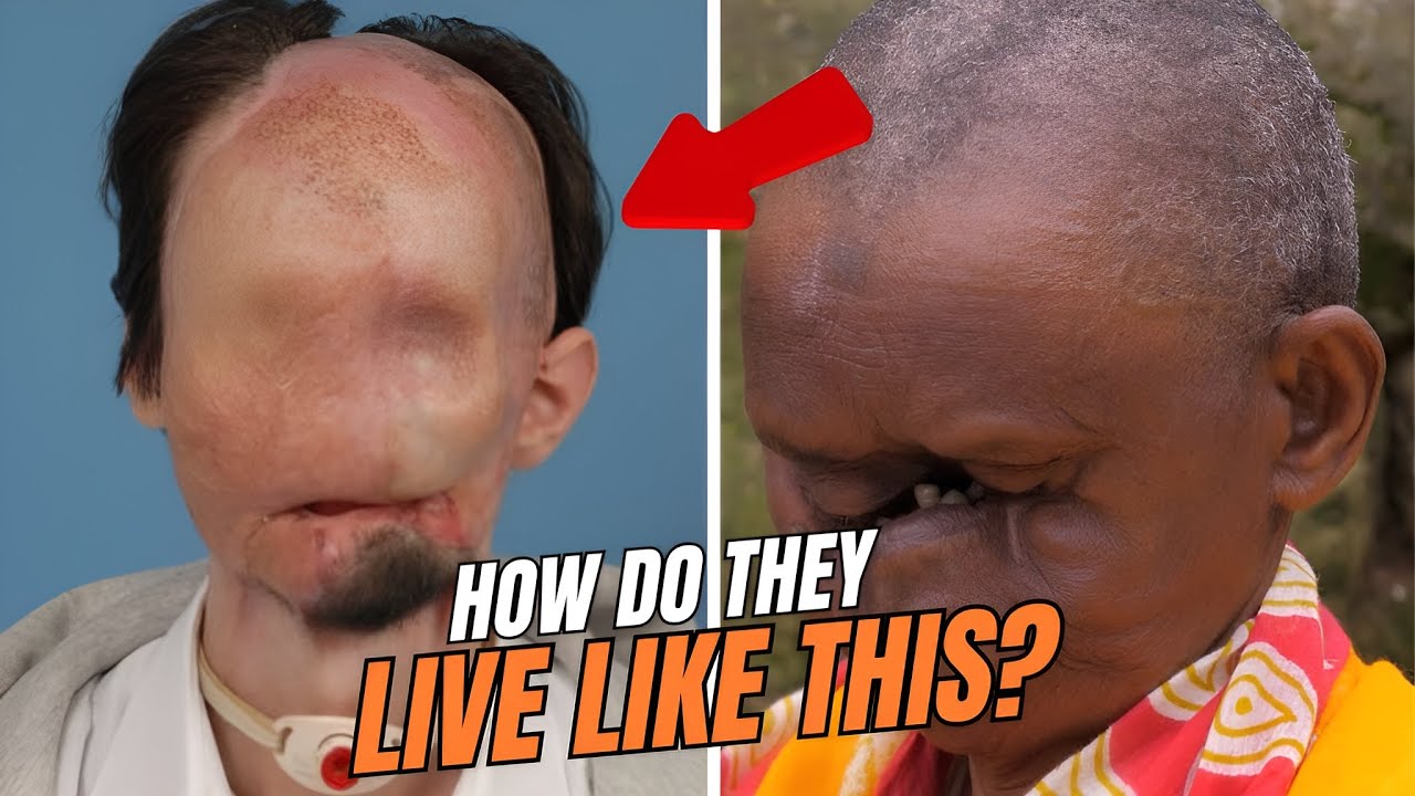 FACELESS PEOPLE‼️ HERE ARE 10 UNIQUE AND STRANGE PEOPLE IN THE WORLD ...