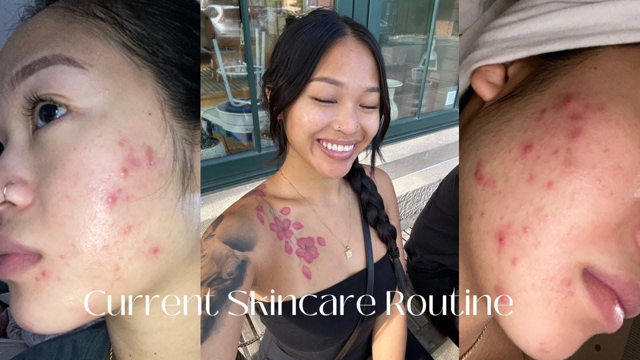 My Skin care routine and how I got rid of my acne! - YouTube