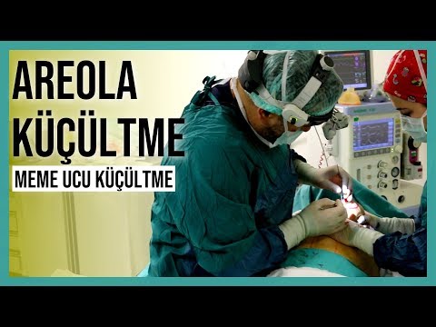 Göğüs Ucu Etrafındaki Renkli Kısmın Çapını Küçültme