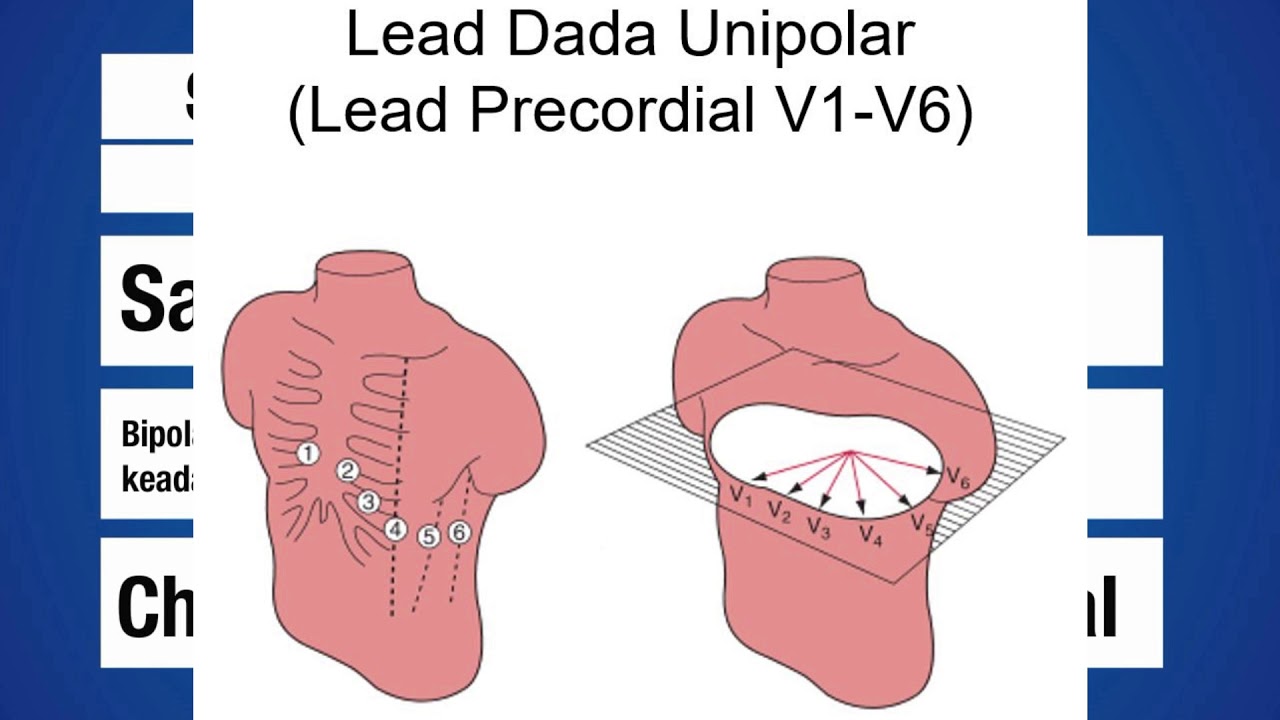 Rekayasa Medika - Video Animasi EKG (Kelompok 3) - YouTube