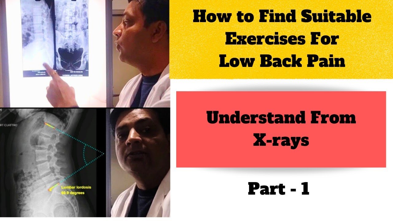 Suitable Exercises for Low Back Pain - Understand from X-rays ! Flexion ...